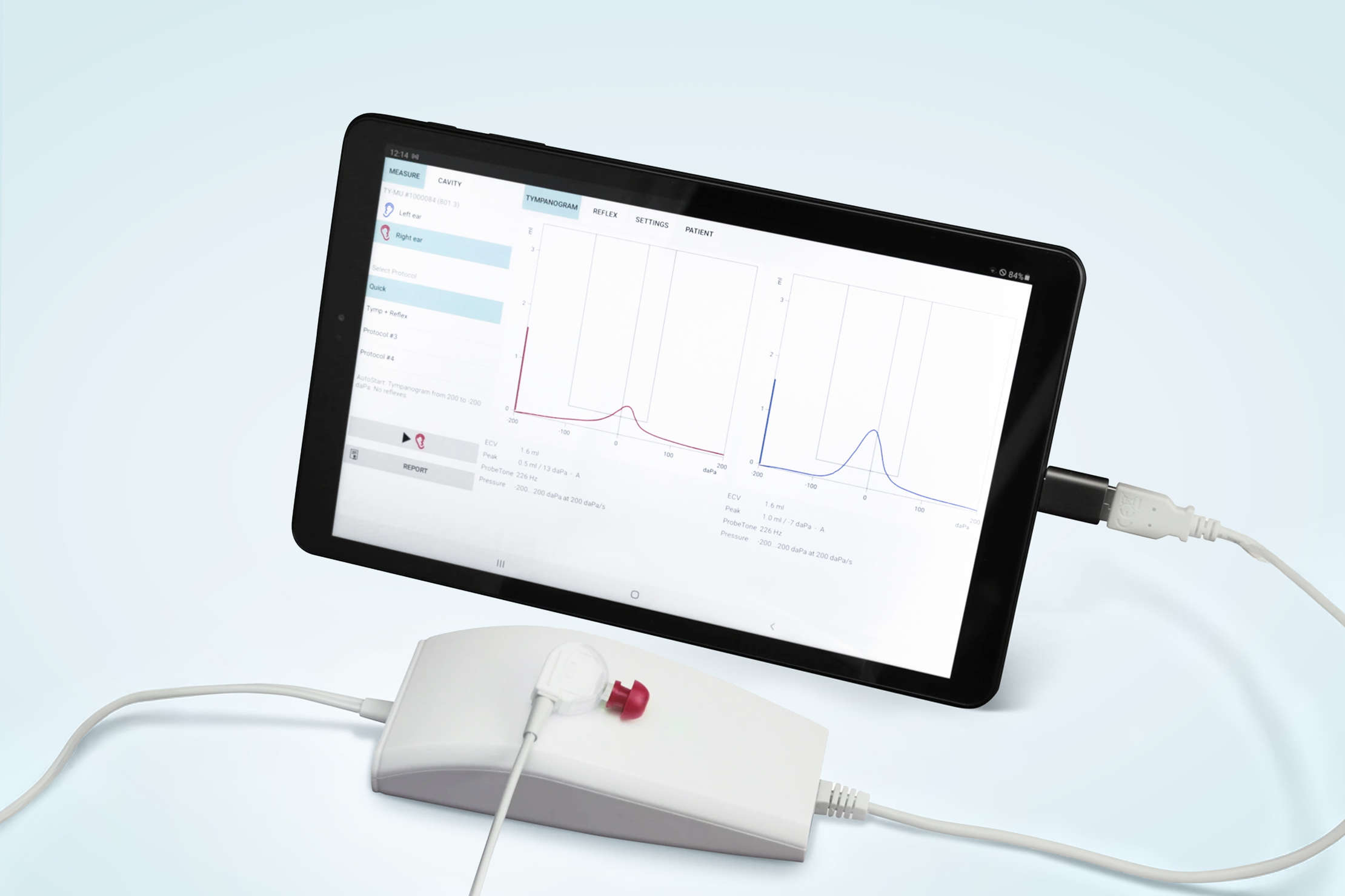 Immittance Audiometry: Accoustic Immittance Testing