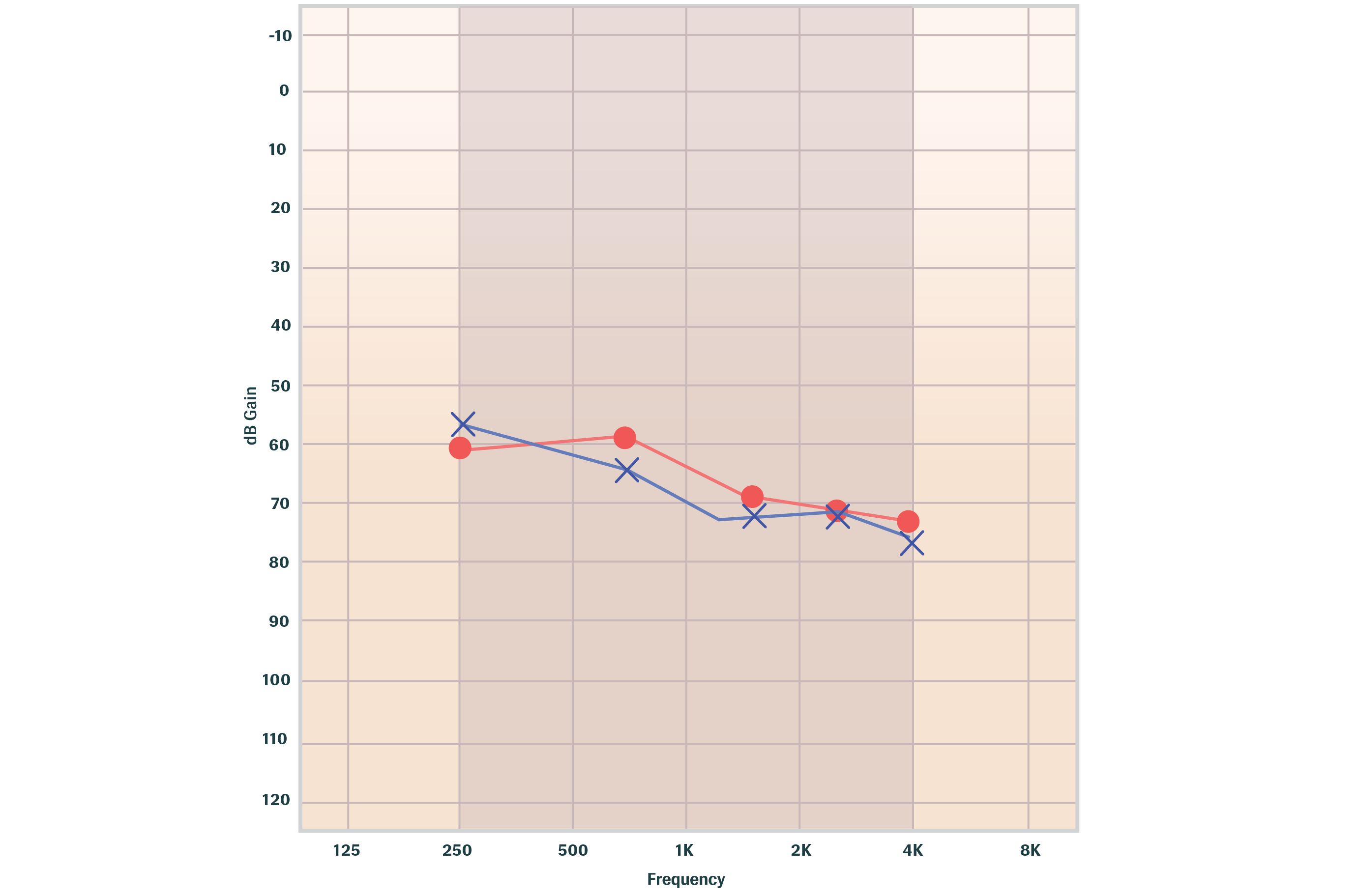 Bone Conduction Testing: What is Bone Conduction?