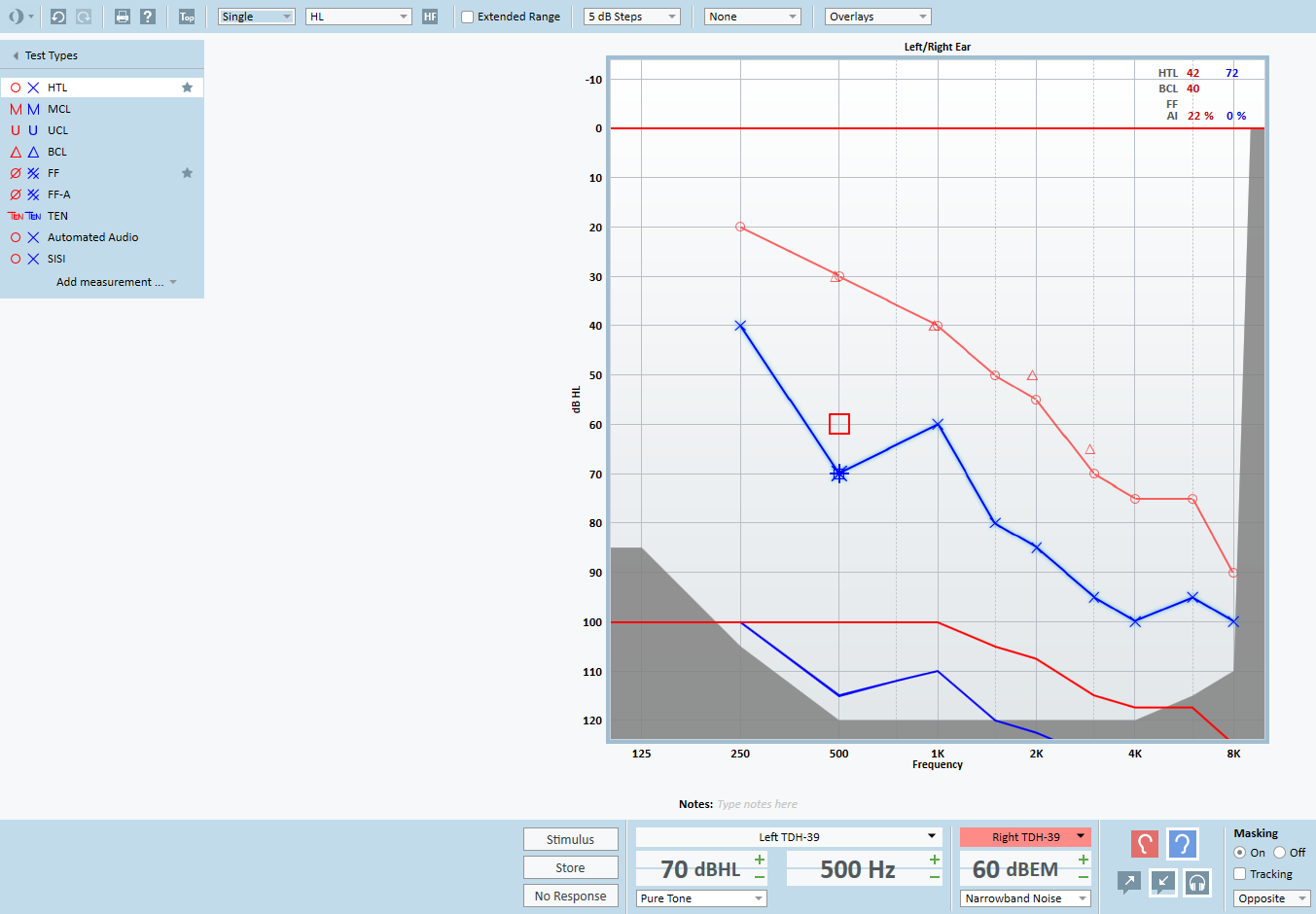 What is Audiometric Masking?