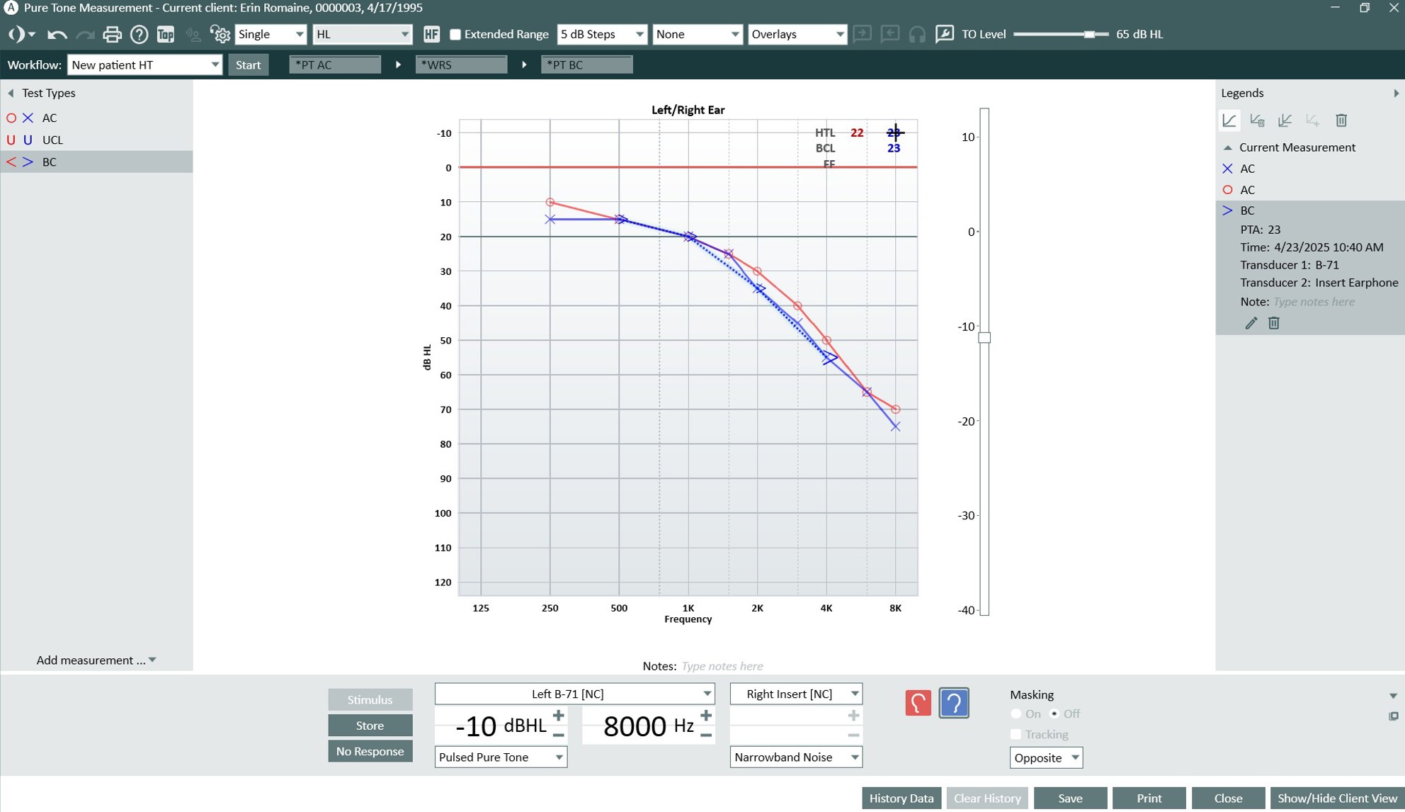 Guide to High-Frequency Hearing Loss & Care